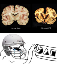 STR8 CTE Meme Sound Effect - Voicy