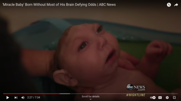 Random Kids yapping Meme Sound Effect - Voicy