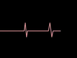 Heartbeat dying Meme Sound Effect - Voicy